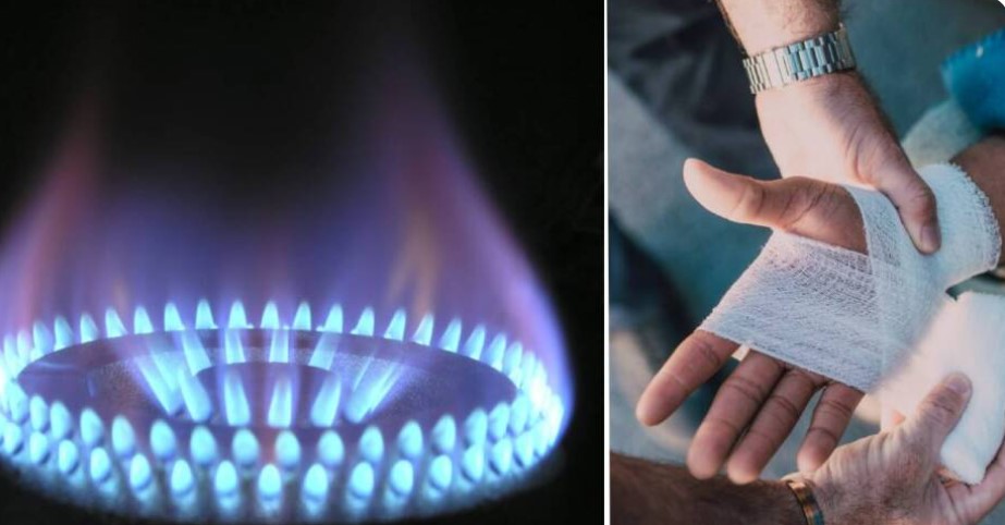 Madre castiga a su hijo de 9 años quemándole las manos en la estufa