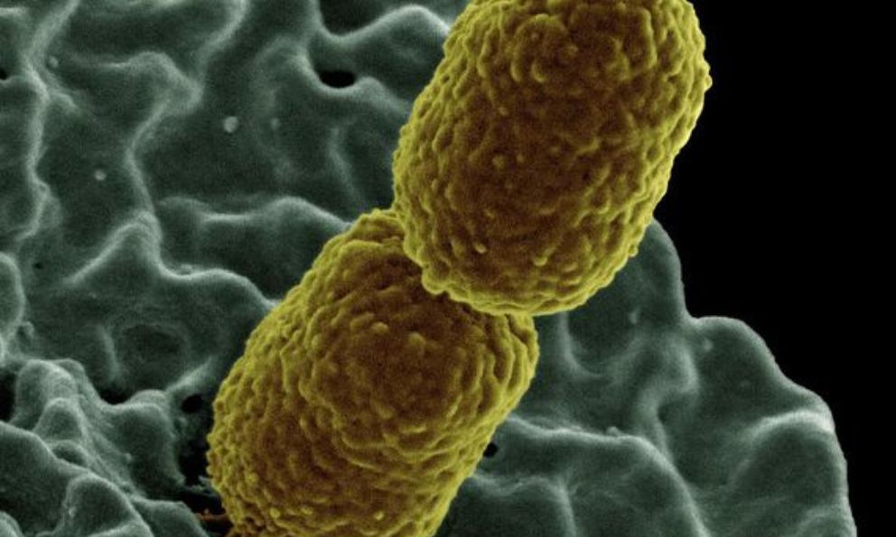 Las superbacterias podrían matar a 10 millones de personas hasta 2050