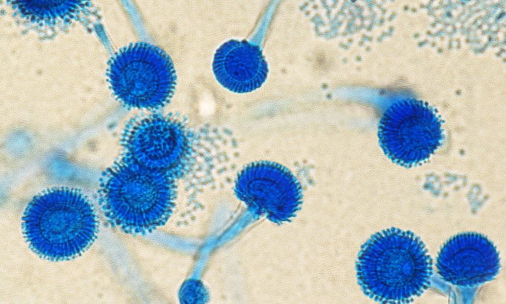 ¿Cuáles son los hongos más peligrosos para los humanos?