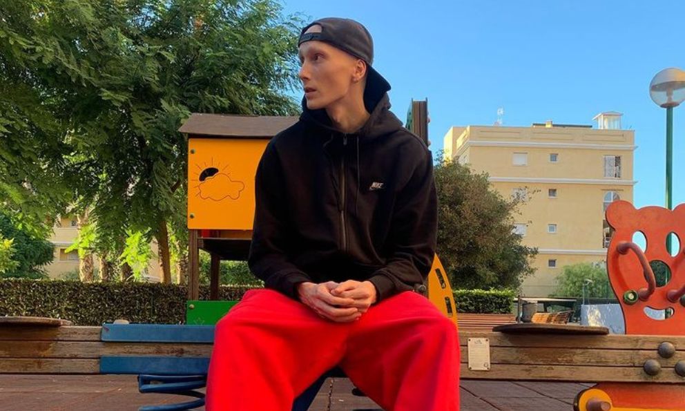 Murió Charlie, influencer que contaba cómo era su vida con cáncer de hueso